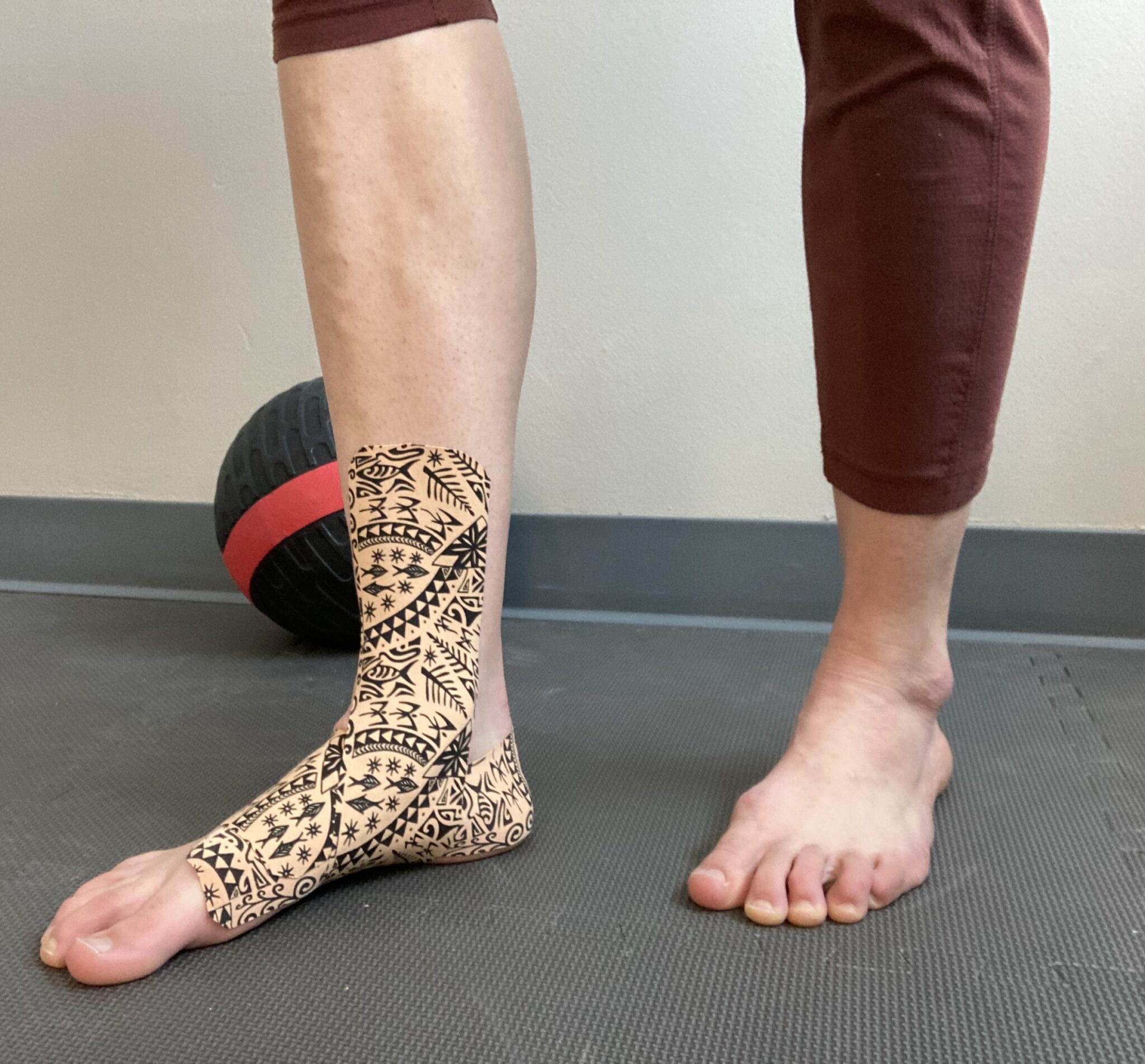 Running with Shin Splints - What Are They?