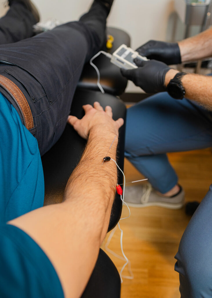 Effective Dry Needling for Physical Therapy & Sports Performance ...